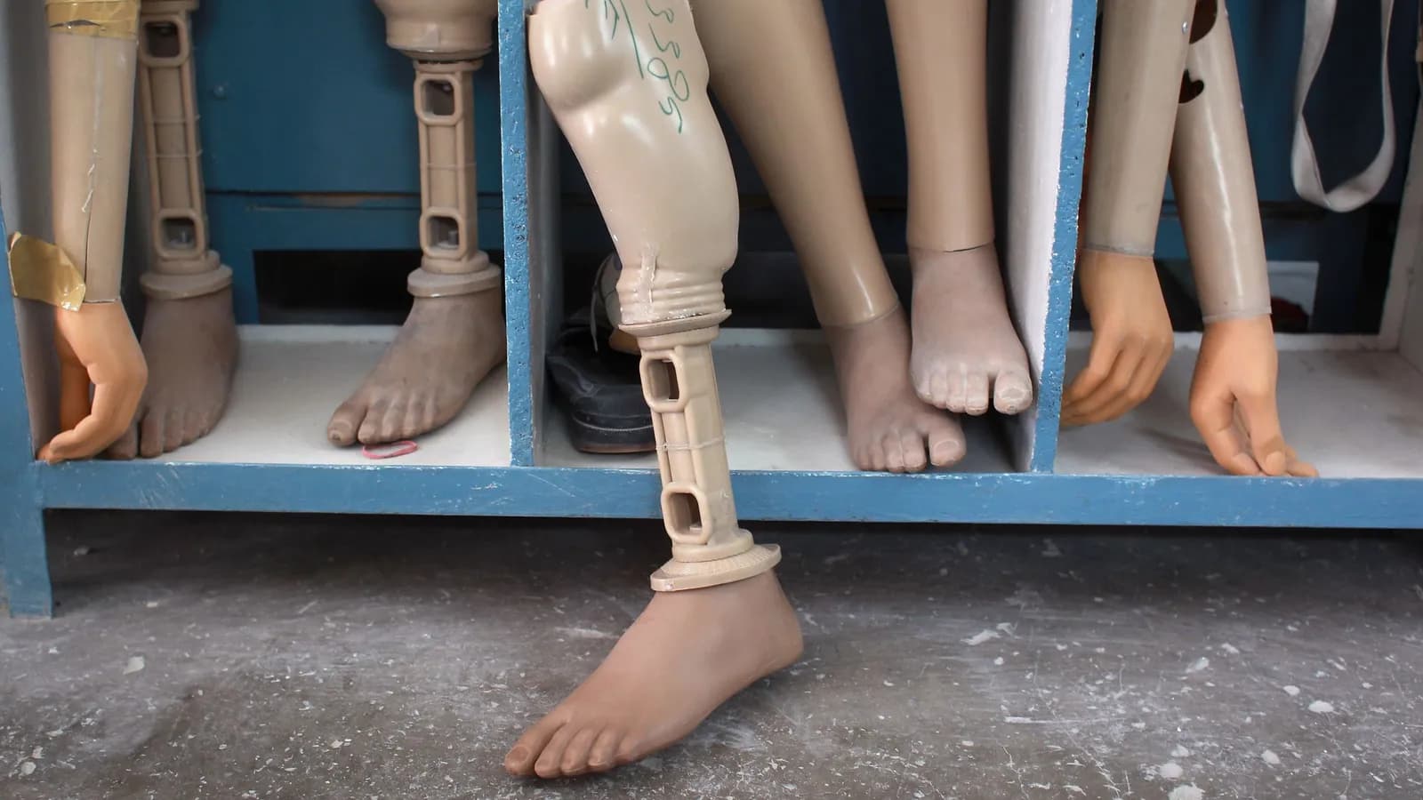 Man left without prosthetic leg after Tasmanian hospital throws it away ...